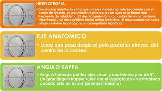 Estrabismo | PPTX
