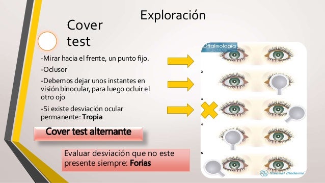 Estrabismo