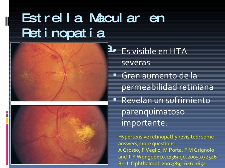 Estrella Macular