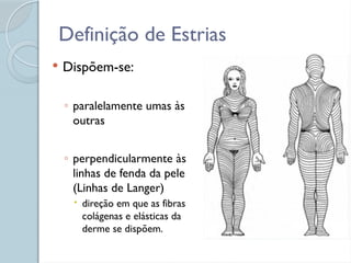 Estrias cutâneas.pptx aula corporal e facial | PPTX