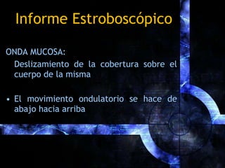 Estroboscopia Laringea