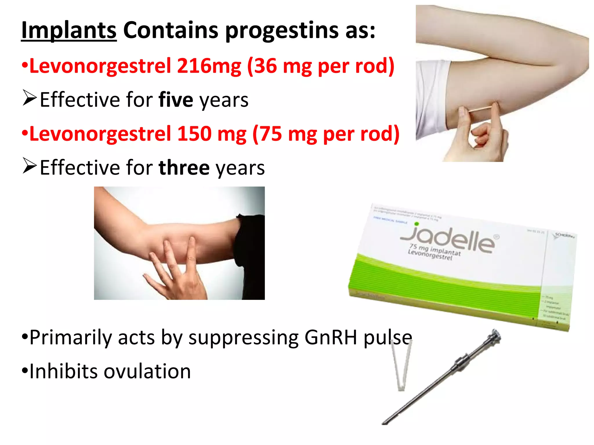 Estrogen, progestin, ocp | PPT