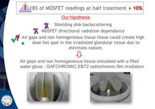 IORT_ in vivo dosimetry | PPT