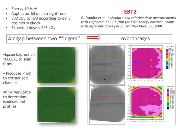 IORT_ in vivo dosimetry | PPT