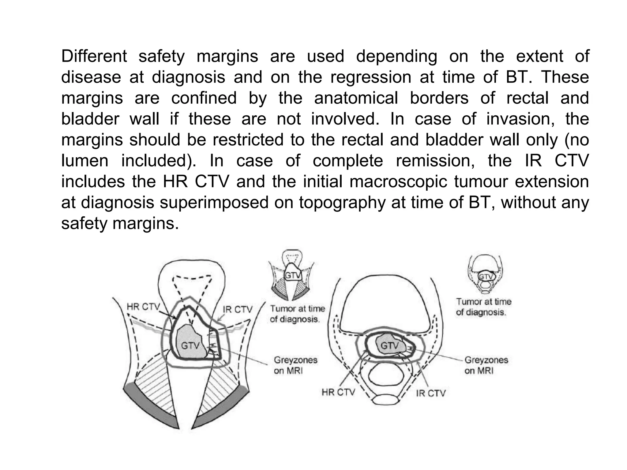 Estro_revised brachy therapy cervical .ppt