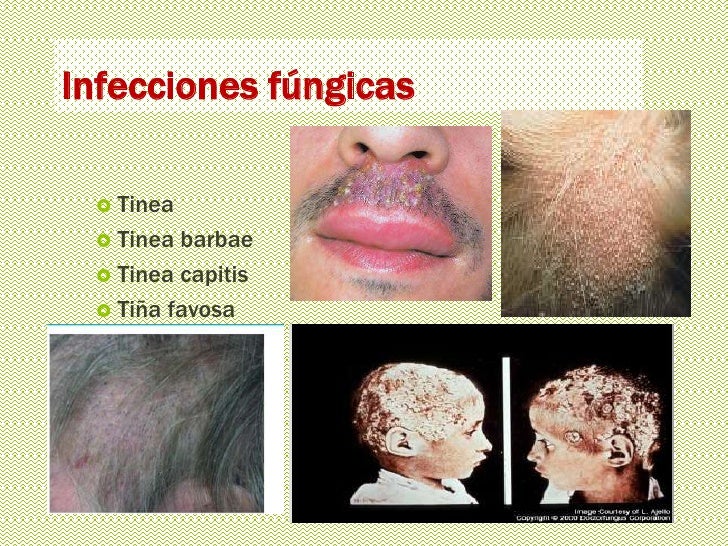 Estructura del cabello