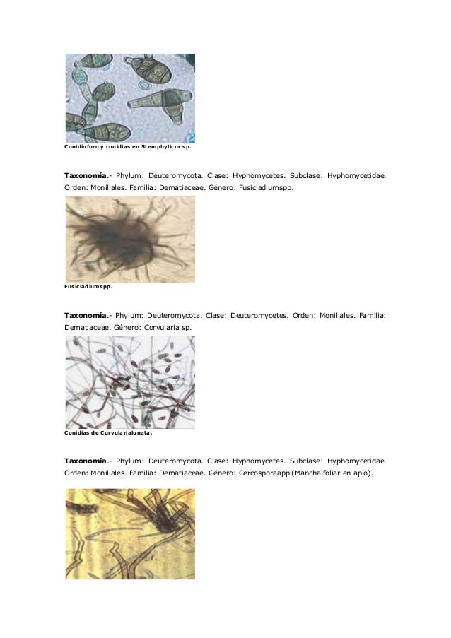 Phylum Deuteromycota Examples
