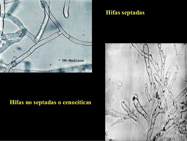 Estructura hongos