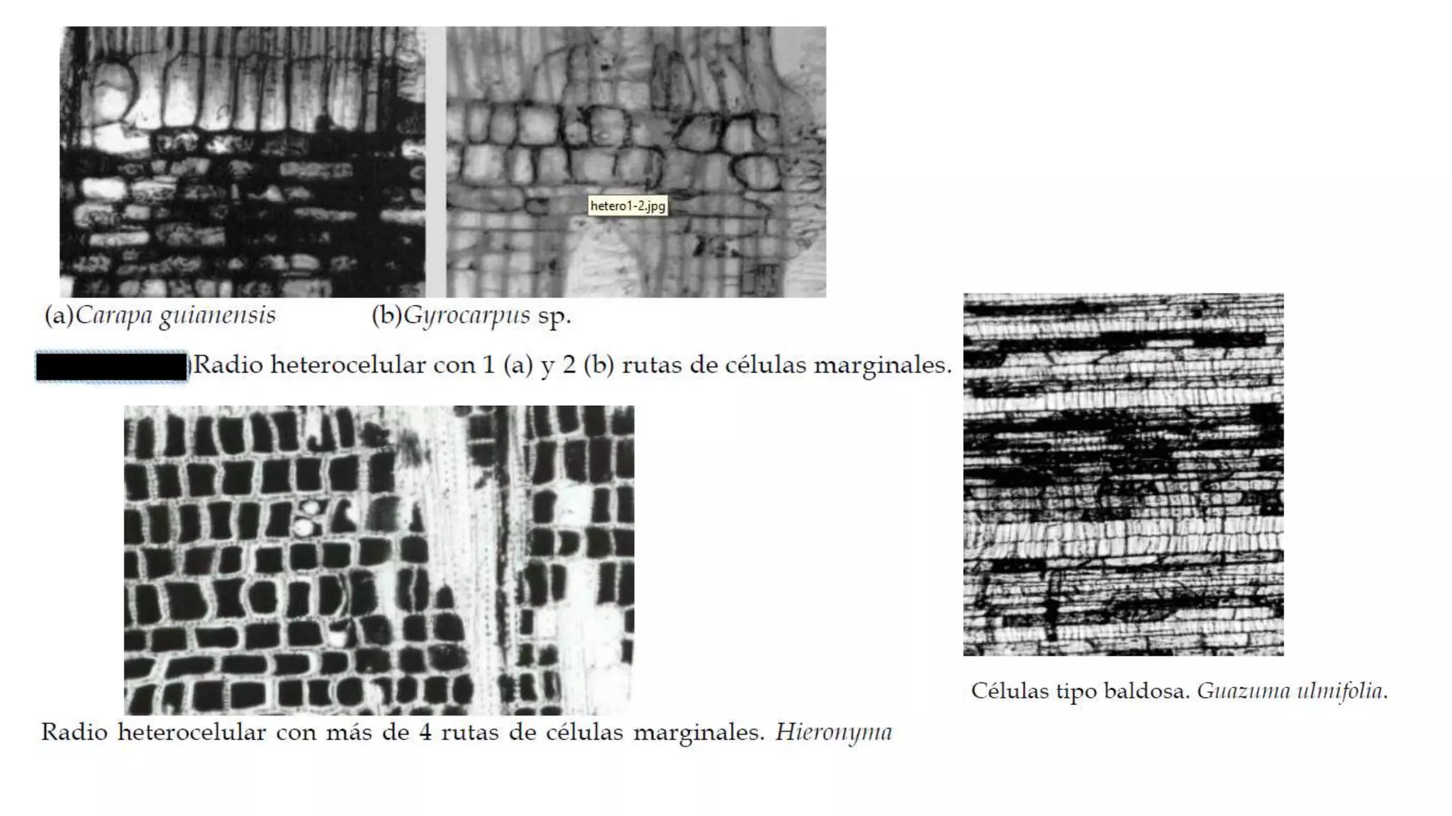 Estructura microscopica de latifoliadas | PPTX