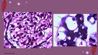 Estructura normal del glomérulo Nefrologia nefropatología.pptx