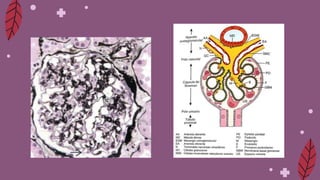 Estructura normal del glomérulo Nefrologia nefropatología.pptx