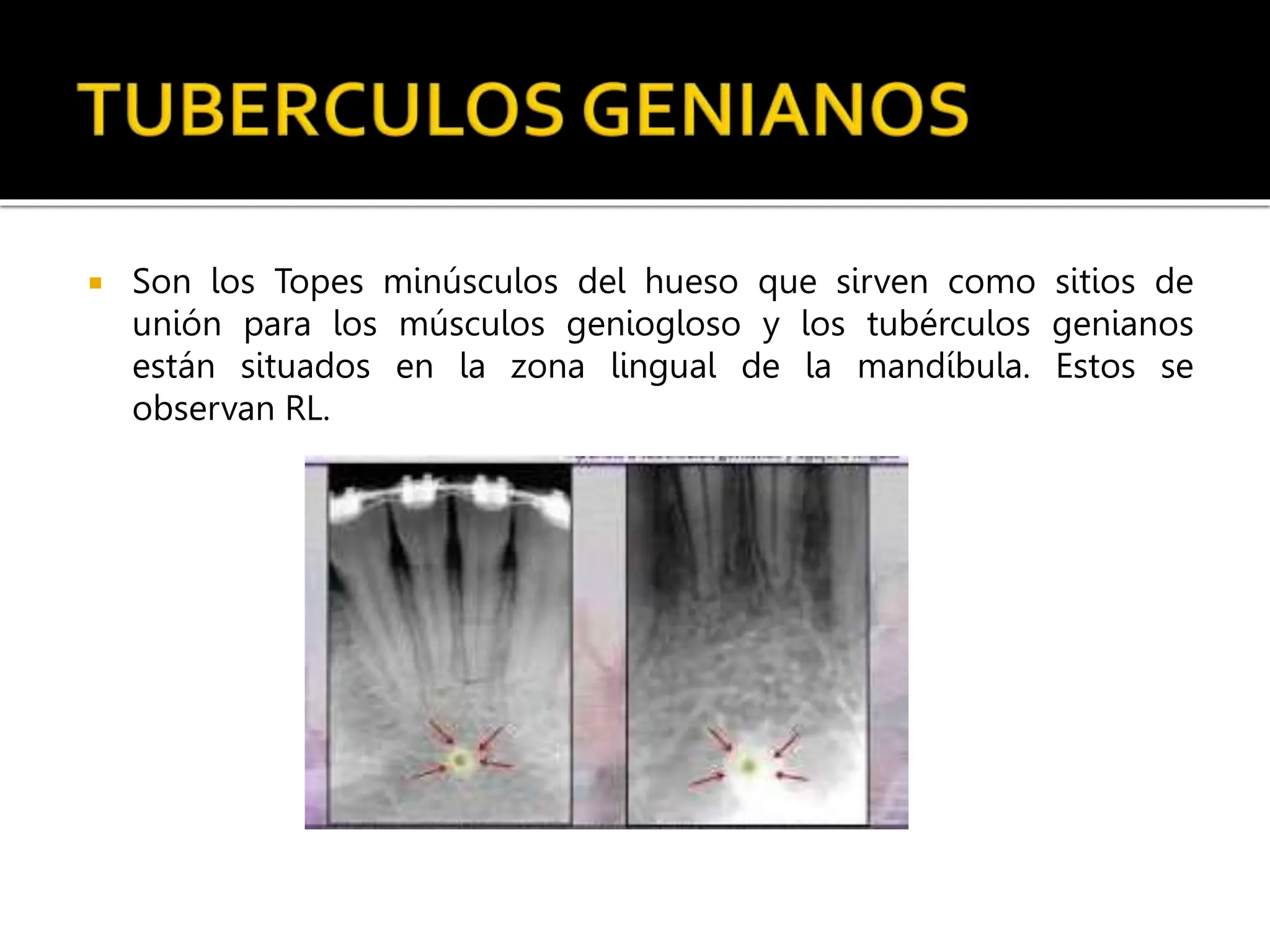 ESTRUCTURAS ANATOMICAS DEL MAXILAR INFERIOR_105255 (3).pptx