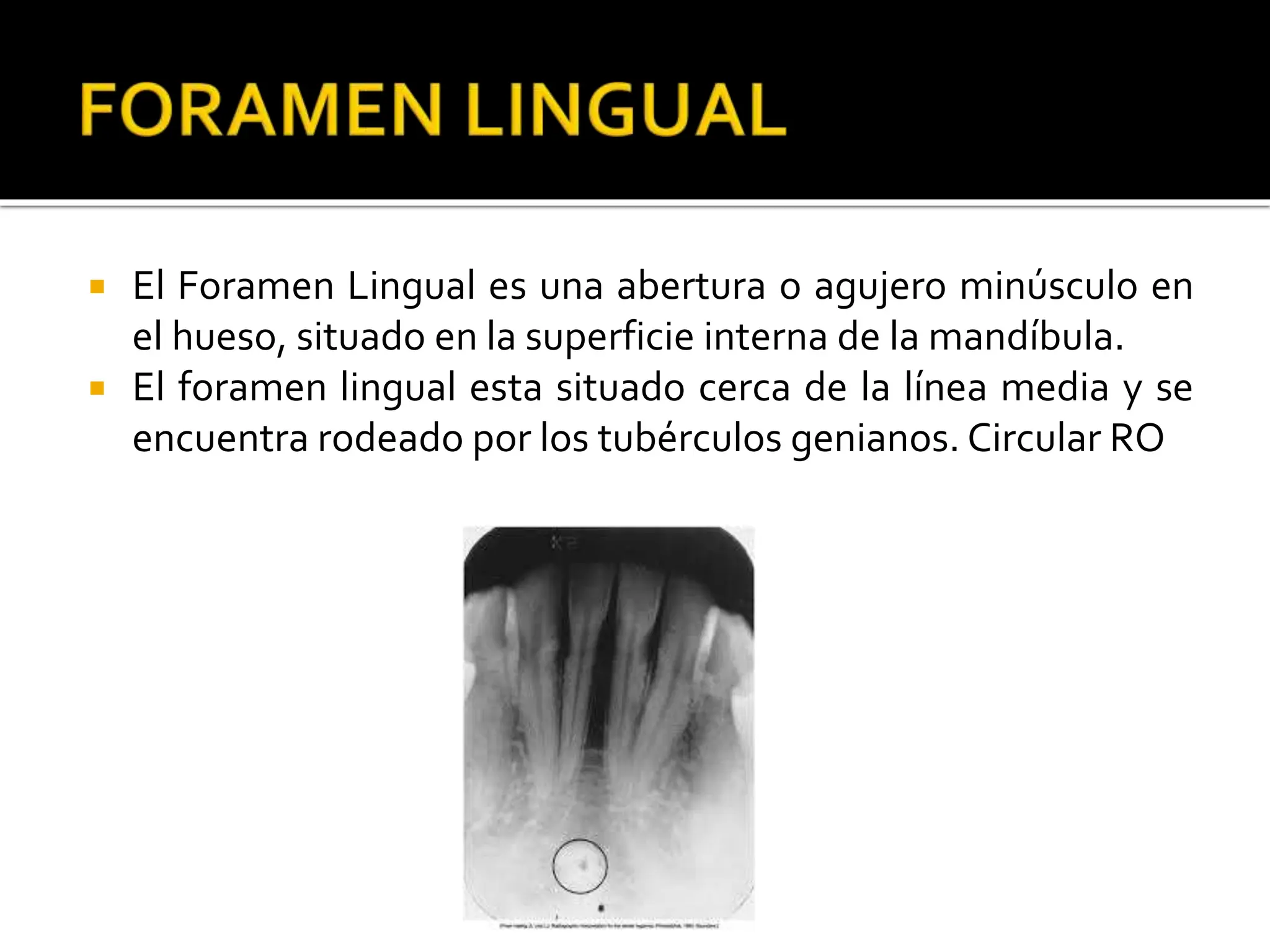 ESTRUCTURAS ANATOMICAS DEL MAXILAR INFERIOR_105255 (3).pptx