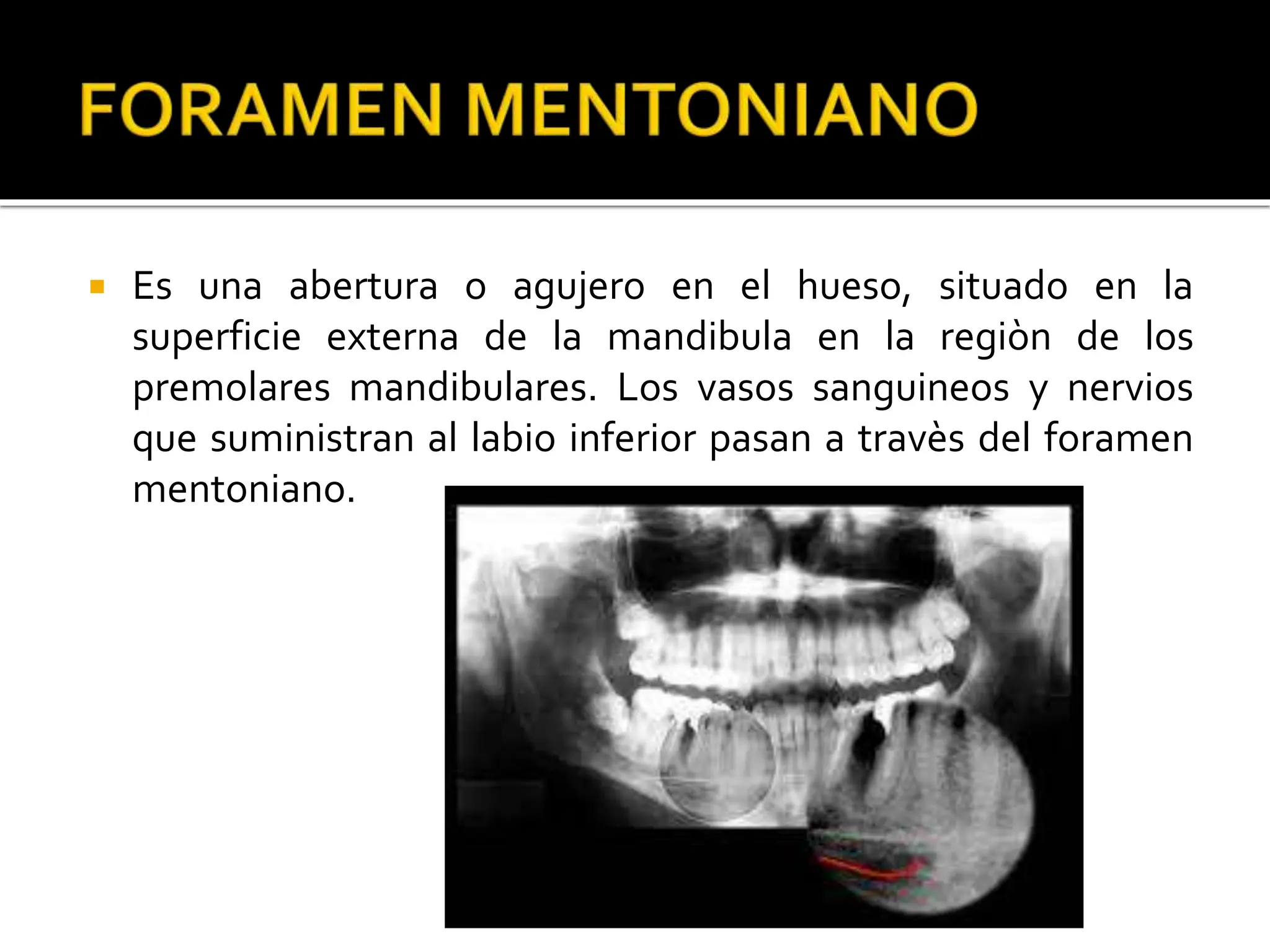 ESTRUCTURAS ANATOMICAS DEL MAXILAR INFERIOR_105255 (3).pptx