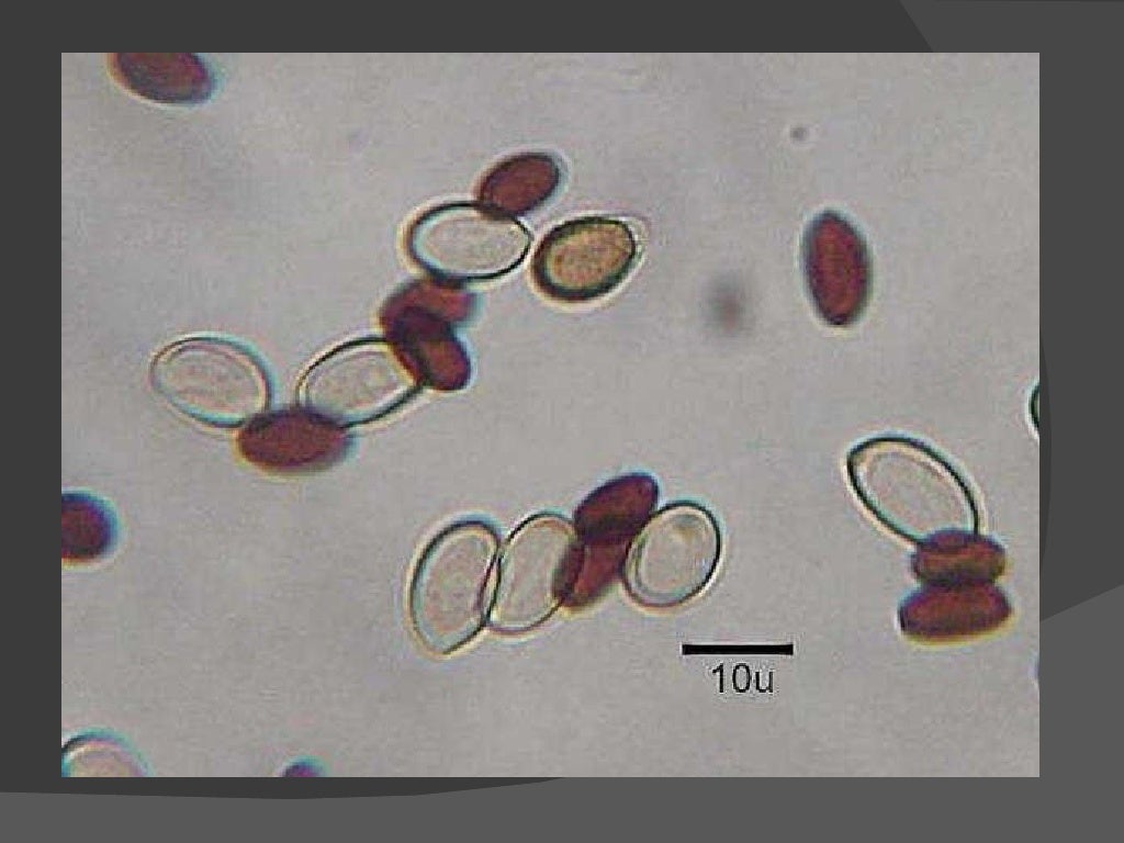 Estructuras de los hongos fitopatogenos