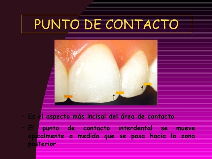 ¿Qué Es La Col Interdental? | La importancia de la higiene interdental ...