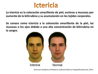 Estudio del-paciente-con-ictericia | PPTX