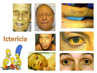 Estudio del-paciente-con-ictericia | PPTX