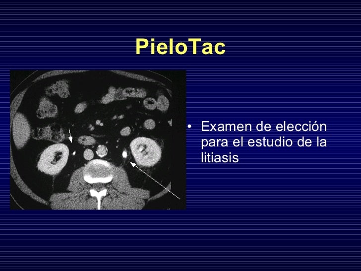 Estudio Renal