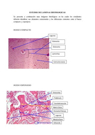 Diagrama De Hueso Compacto Y Esponjoso