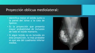 Estudio de la patologia mamaria terminologia basica | PPTX