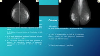 Estudio de la patologia mamaria terminologia basica | PPTX