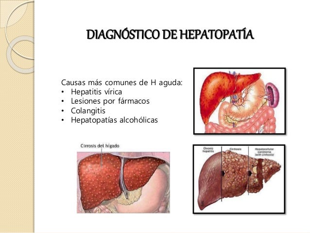 Estudio del paciente con enfermedad hepática