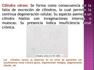 ESTUDIO DEL SEDIMENTO.pptx