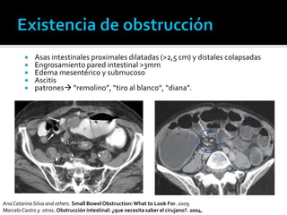 Estudio imagenológico de obstrucción intestinal | PDF