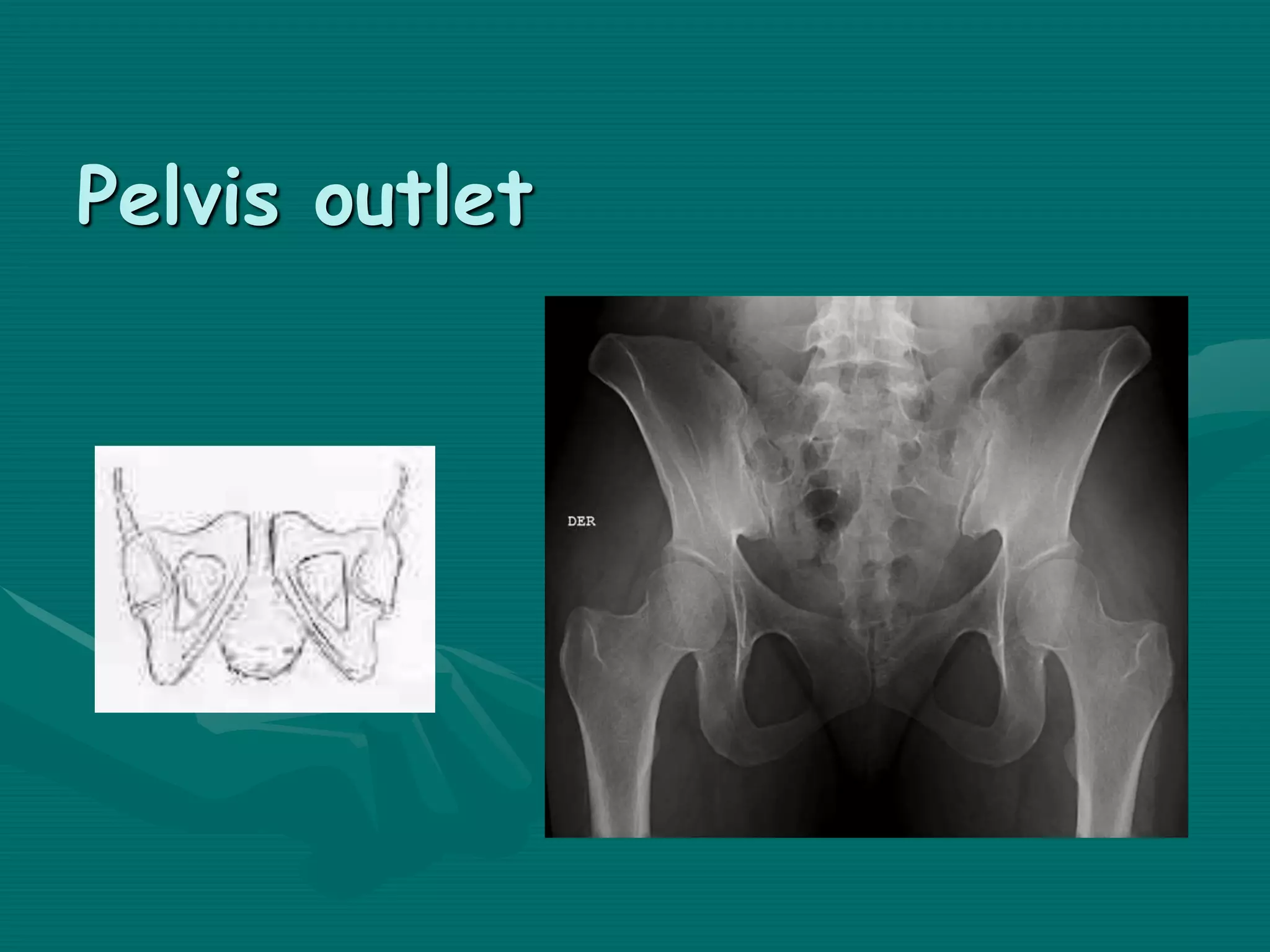 Estudio radiografico cadera y pelvis.ppt