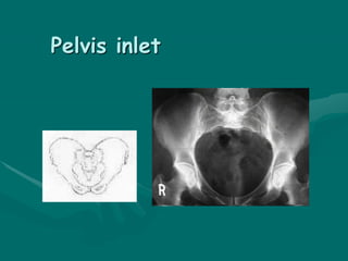 Estudio radiografico cadera y pelvis.ppt