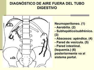 Estudio radiografico simple del abdomen. DRA MARROQUIN | PPT