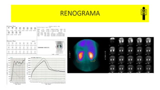 ESTUDIO RADIOLÓGICO DEL APARATO URINARIO | PDF