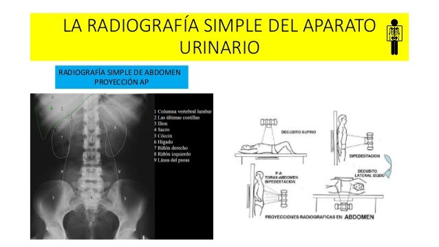 ESTUDIO RADIOLÓGICO DEL APARATO URINARIO