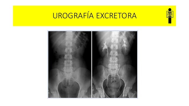 ESTUDIO RADIOLÓGICO DEL APARATO URINARIO