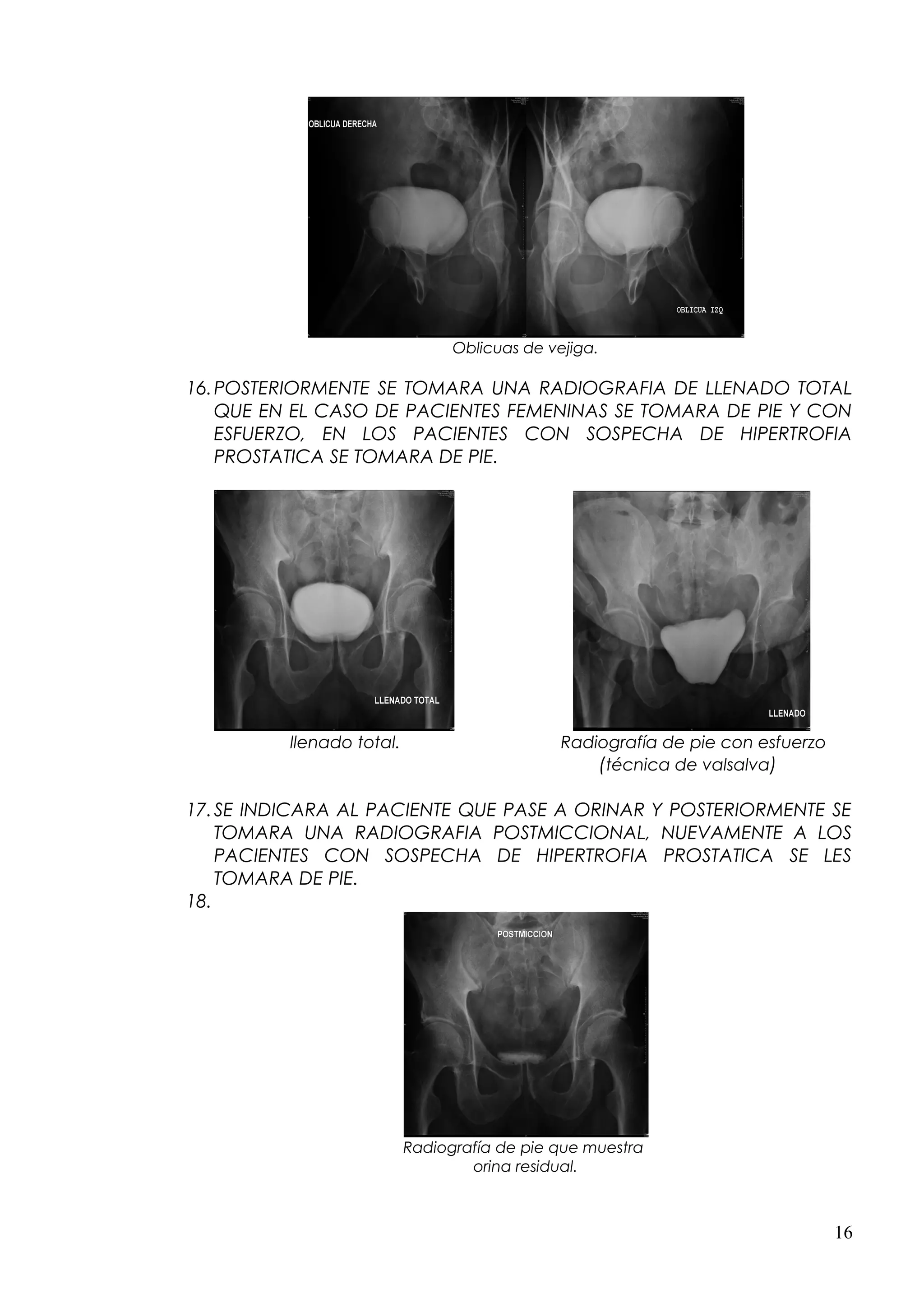 ESTUDIOS CONTRASTADOS PROCEDIMIENTO Y PROYECCIONES RADIOLOGICAS | DOC