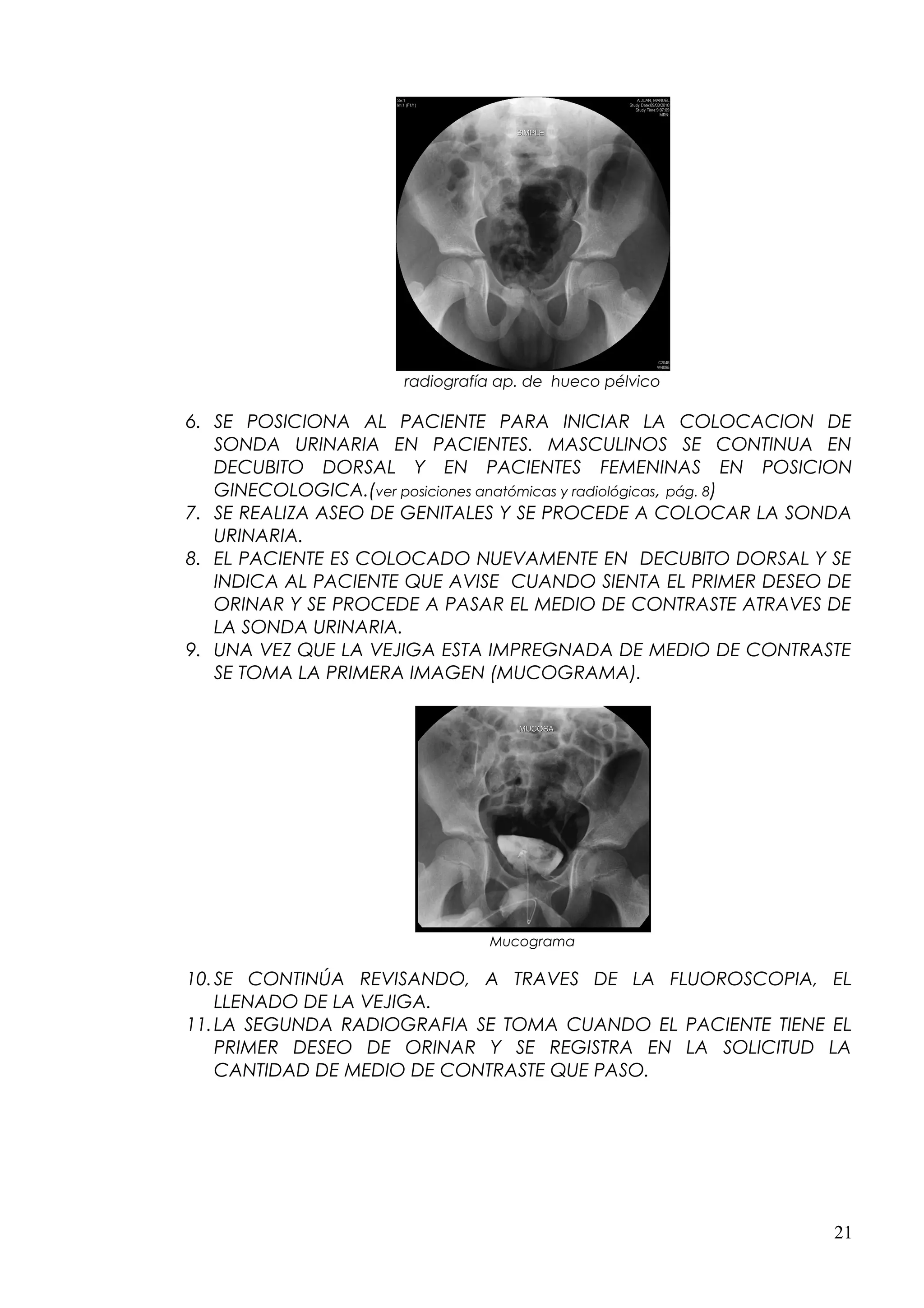 ESTUDIOS CONTRASTADOS PROCEDIMIENTO Y PROYECCIONES RADIOLOGICAS | DOC