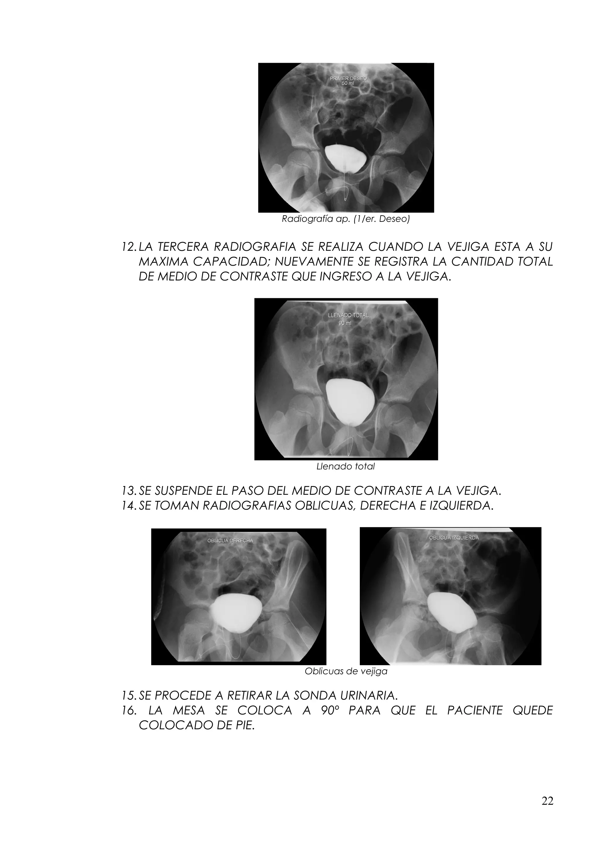 ESTUDIOS CONTRASTADOS PROCEDIMIENTO Y PROYECCIONES RADIOLOGICAS | DOC