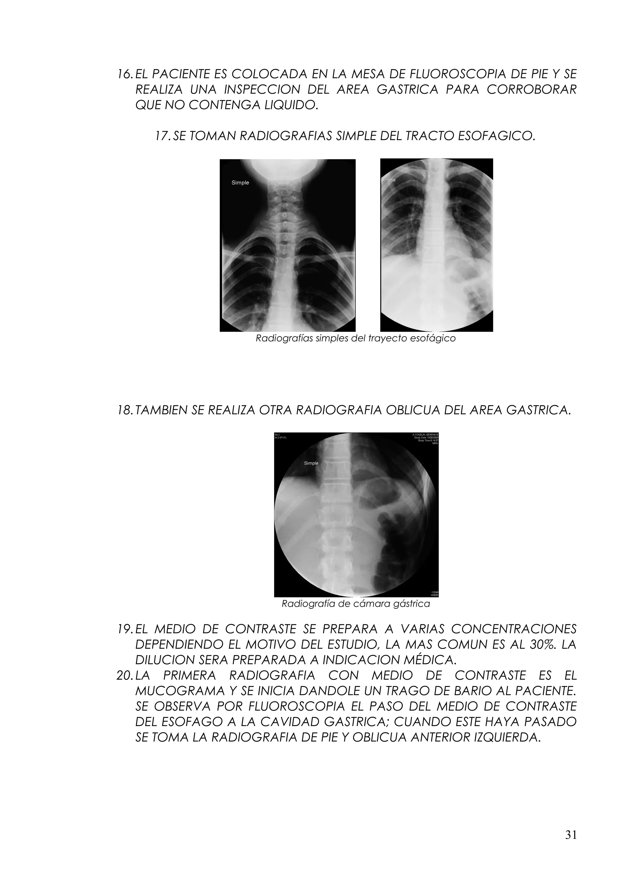 ESTUDIOS CONTRASTADOS PROCEDIMIENTO Y PROYECCIONES RADIOLOGICAS | DOC