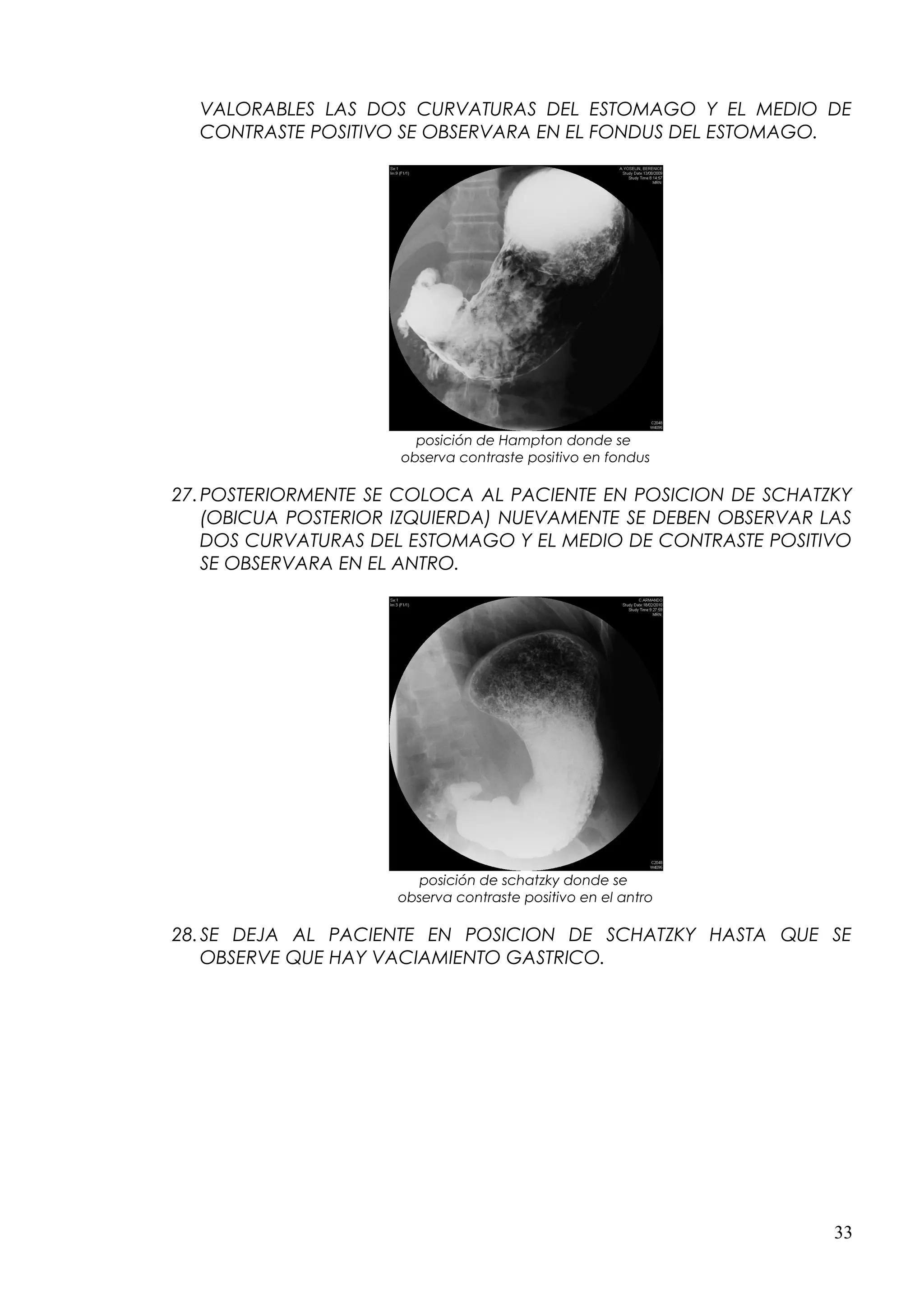 ESTUDIOS CONTRASTADOS PROCEDIMIENTO Y PROYECCIONES RADIOLOGICAS | DOC