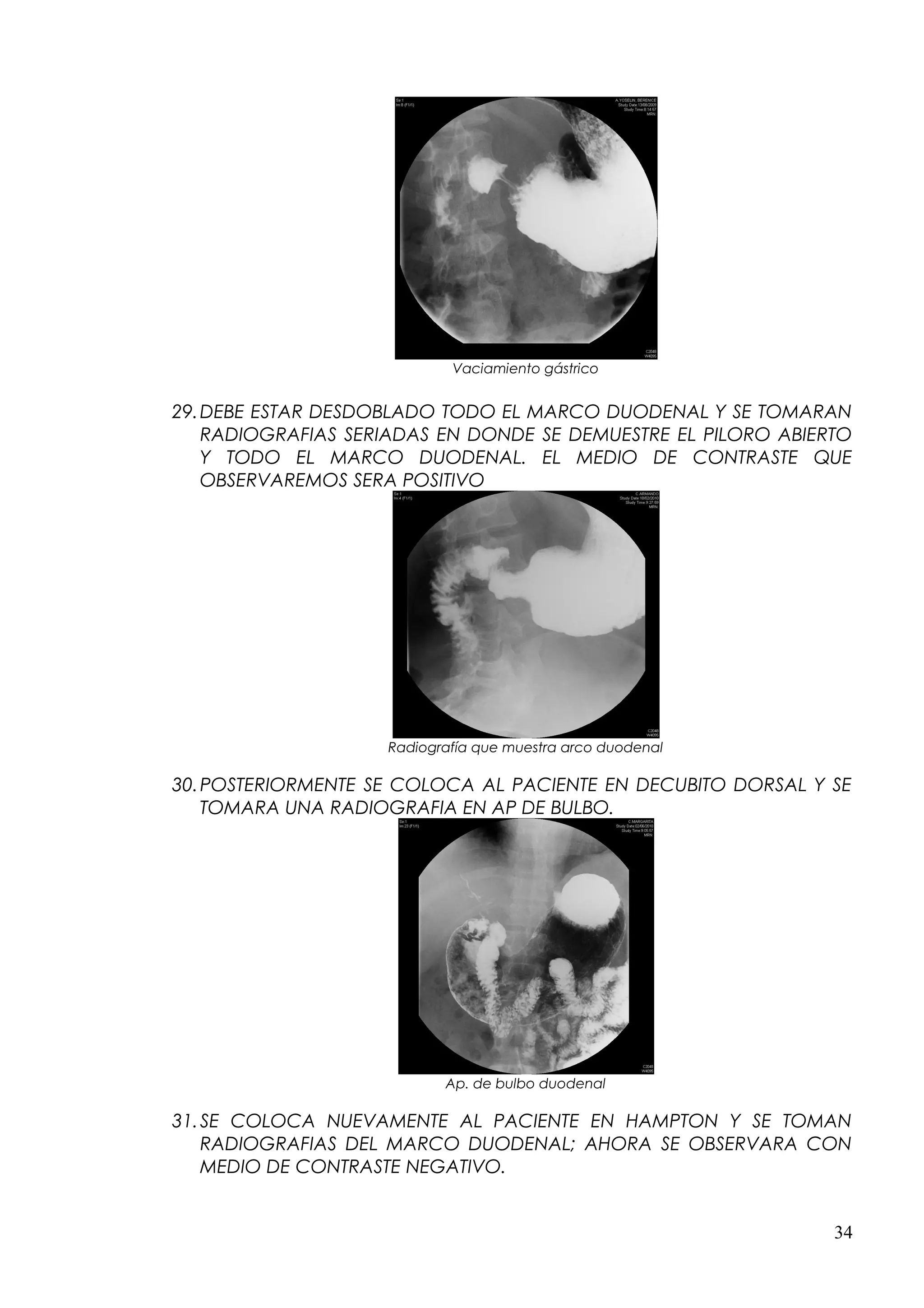 ESTUDIOS CONTRASTADOS PROCEDIMIENTO Y PROYECCIONES RADIOLOGICAS | DOC