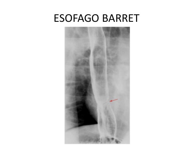 Estudios contrastados gastrointestinales - Dra. Marroqui