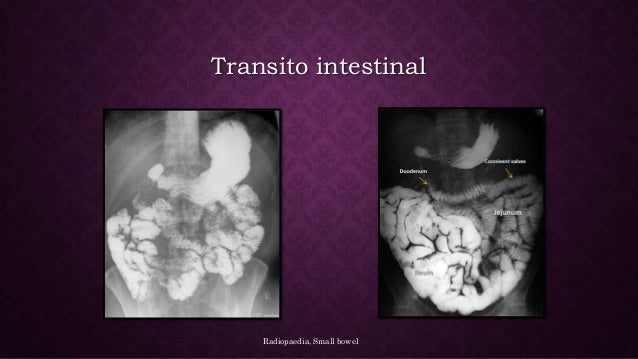 Estudios contrastados simples