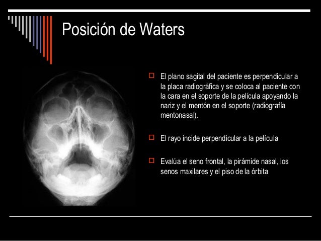Estudios de imagen en otorrinolaringología