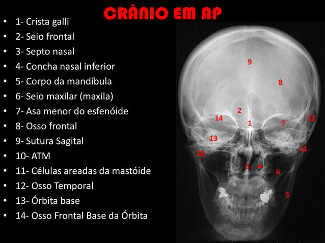 Estudo cranio
