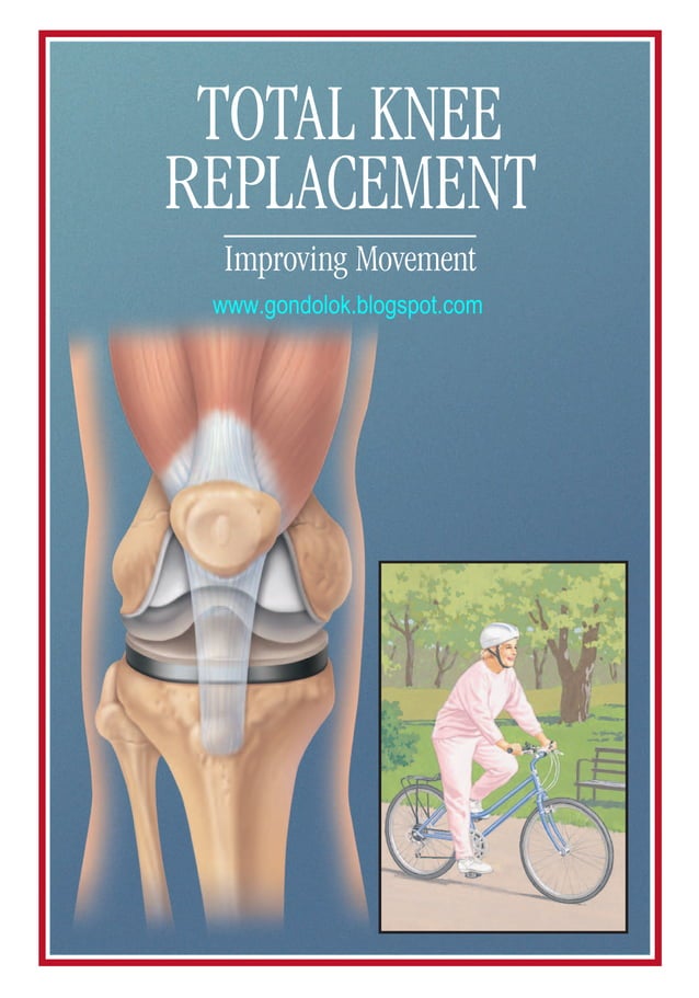 E Sur - Total Knee Replacement.pdf | Bone and Joint Conditions | Diseases and Conditions