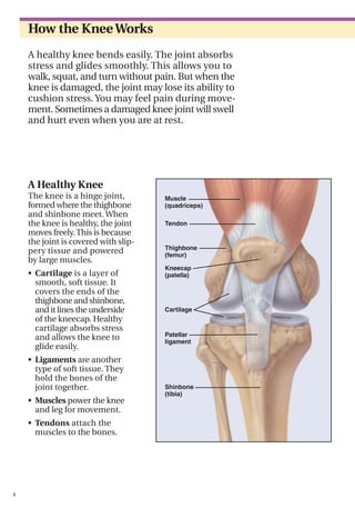 E Sur - Total Knee Replacement.pdf