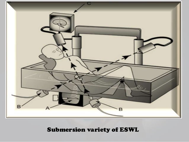 Eswl, PCNL, MAC, Urological procedures