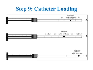 Embryo Transfer | PPTX