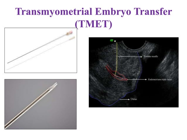 Embryo Transfer | PPTX | Pregnancy | Reproductive Health